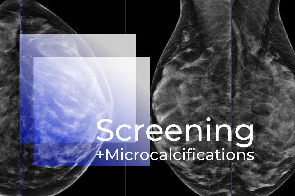 Breast Cancer Screening + Microcalcifications course | Mammologicum