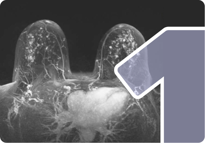 Breast MRI, Basics course | Mammologicum